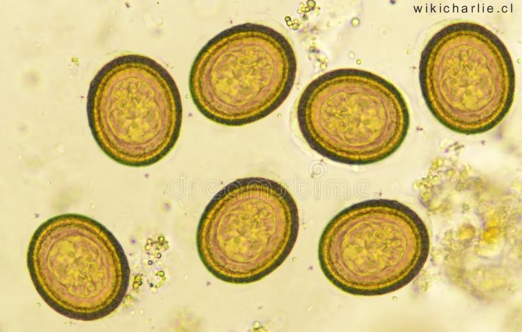 Neurocisticercosis - WikicharliE
