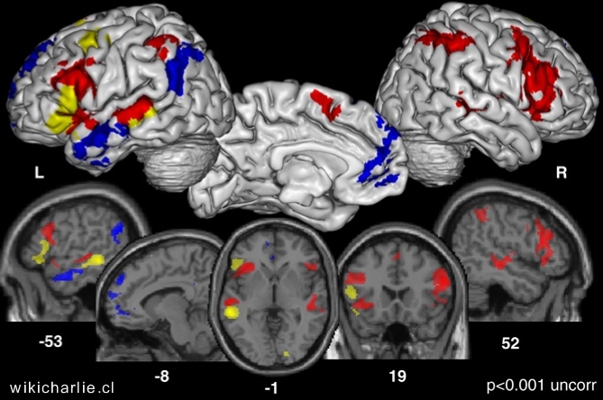 Qué produce la música en nuestro cerebro - WikicharliE